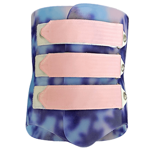 Custom Spinal Braces | | Pro-Tech Orthopedics